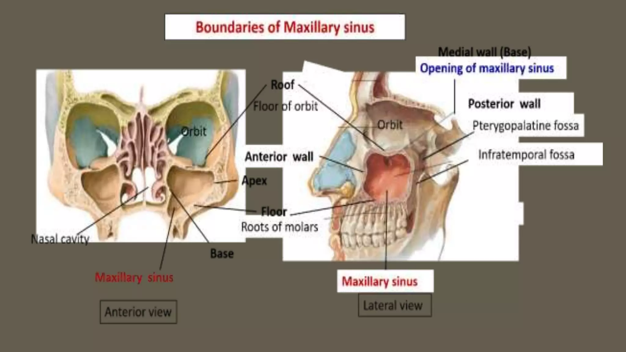 Maxillary sinus | PPTX