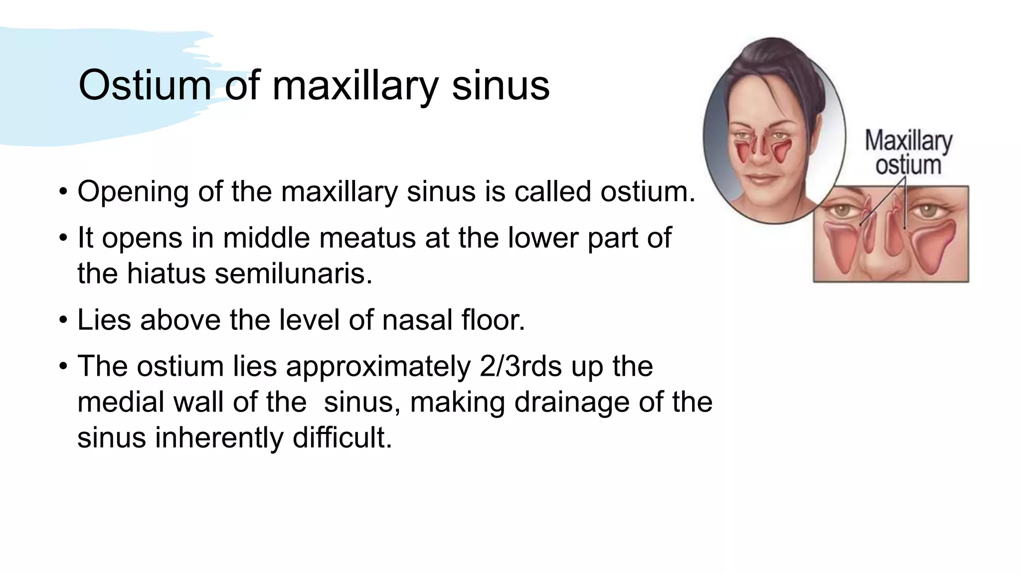 Maxillary sinus | PPTX