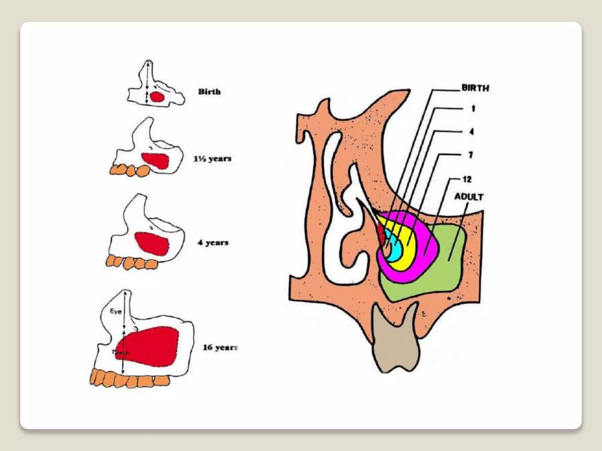 Maxillary sinus.ppt
