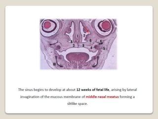 Maxillary sinus.ppt