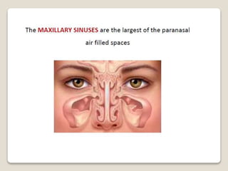 Maxillary sinus.ppt