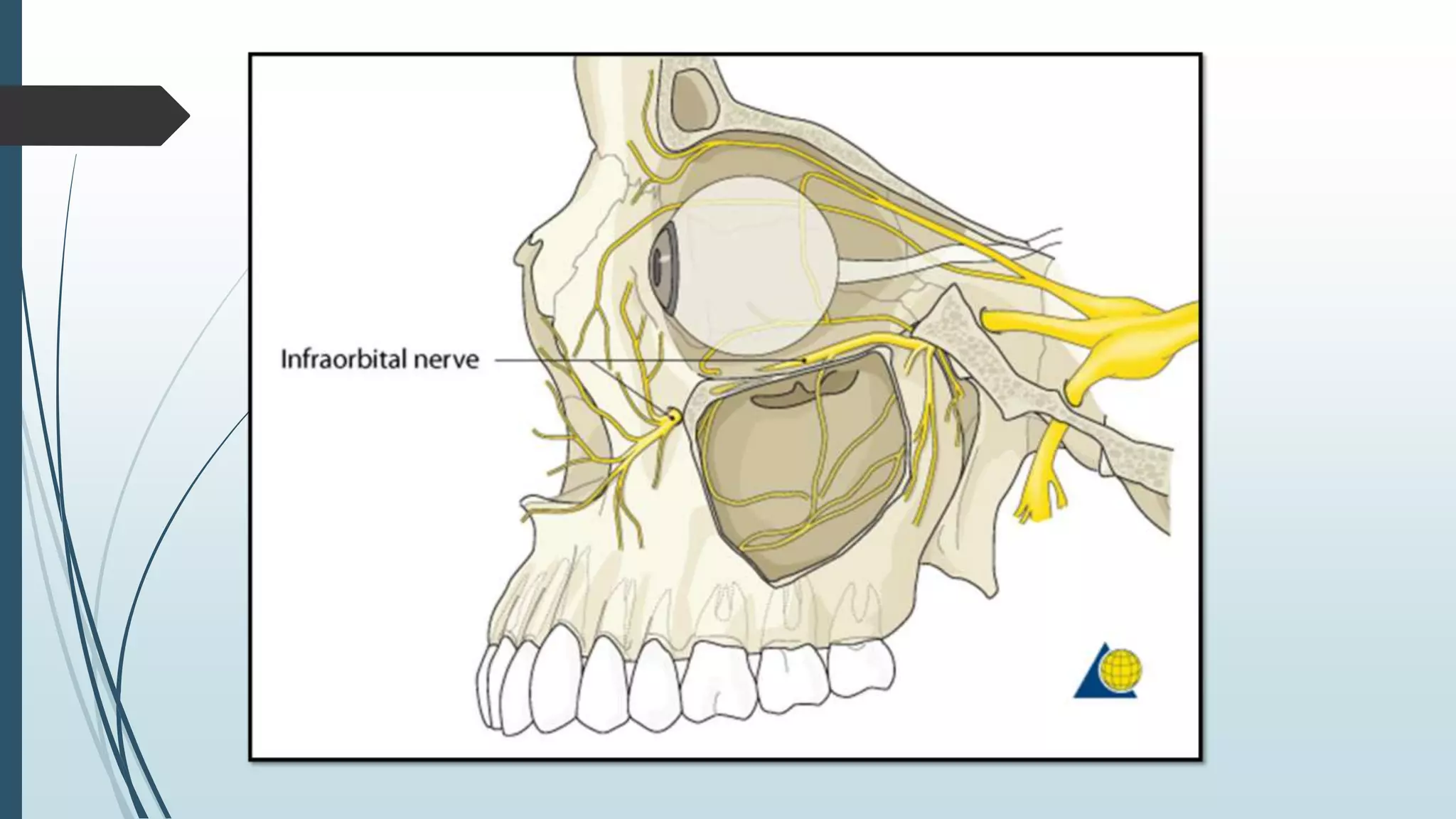 Maxillary Sinus Pptx Ear Nose And Throat Conditions Diseases And Conditions