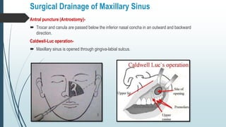 MAXILLARY SINUS.pptx | Ear, Nose and Throat Conditions | Diseases and ...