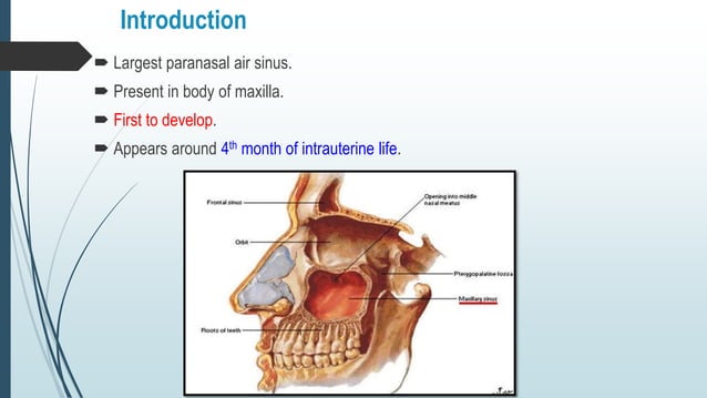 MAXILLARY SINUS.pptx | Ear, Nose and Throat Conditions | Diseases and Conditions