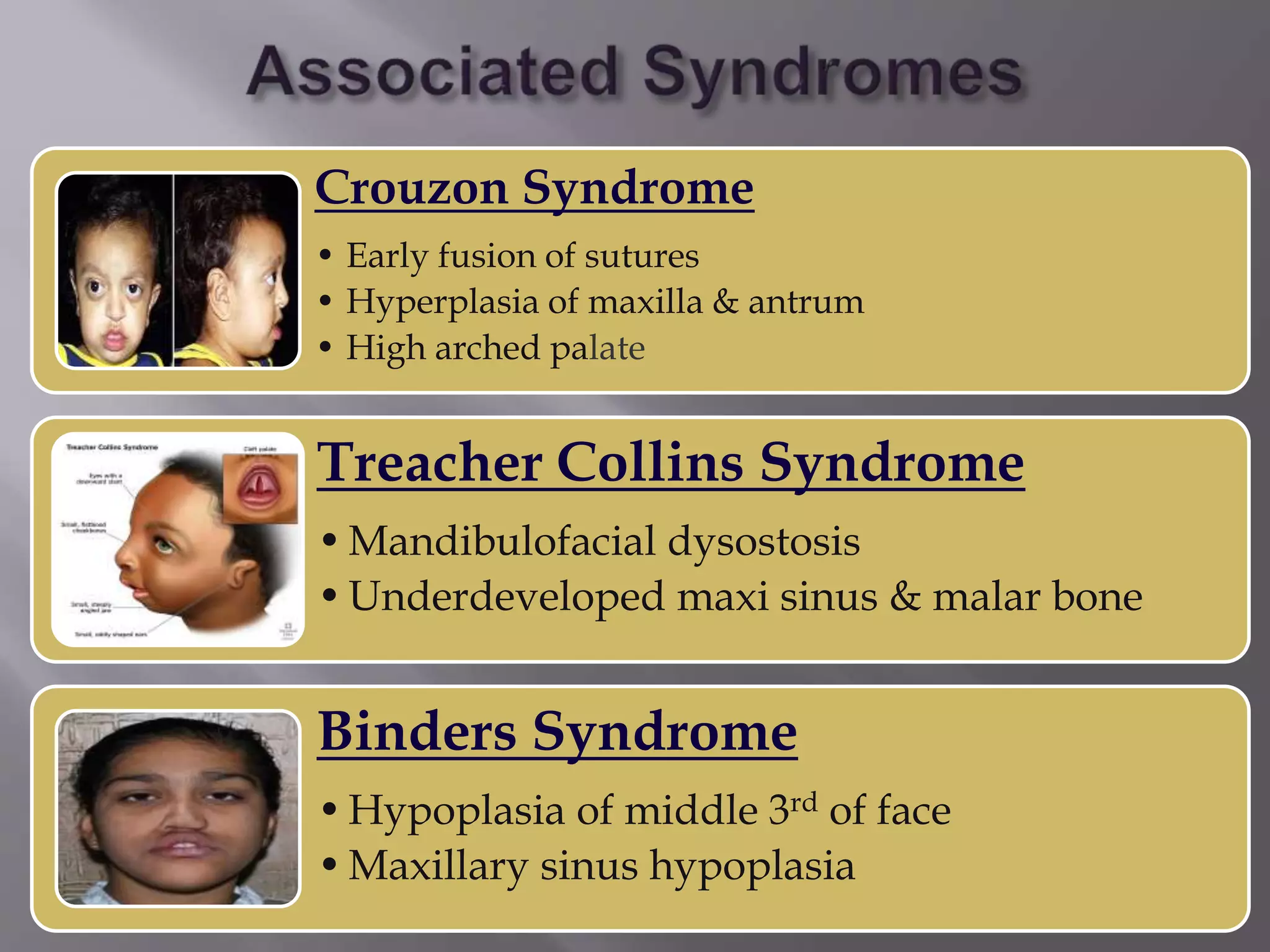 Maxillary Sinus | PPTX
