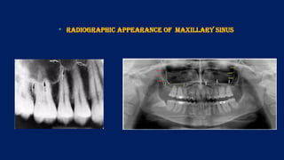Maxillary Sinus.pptx 1st bds lecture histology | PPTX