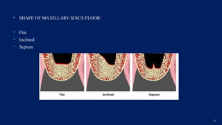Maxillary Sinus.pptx 1st bds lecture histology | PPTX