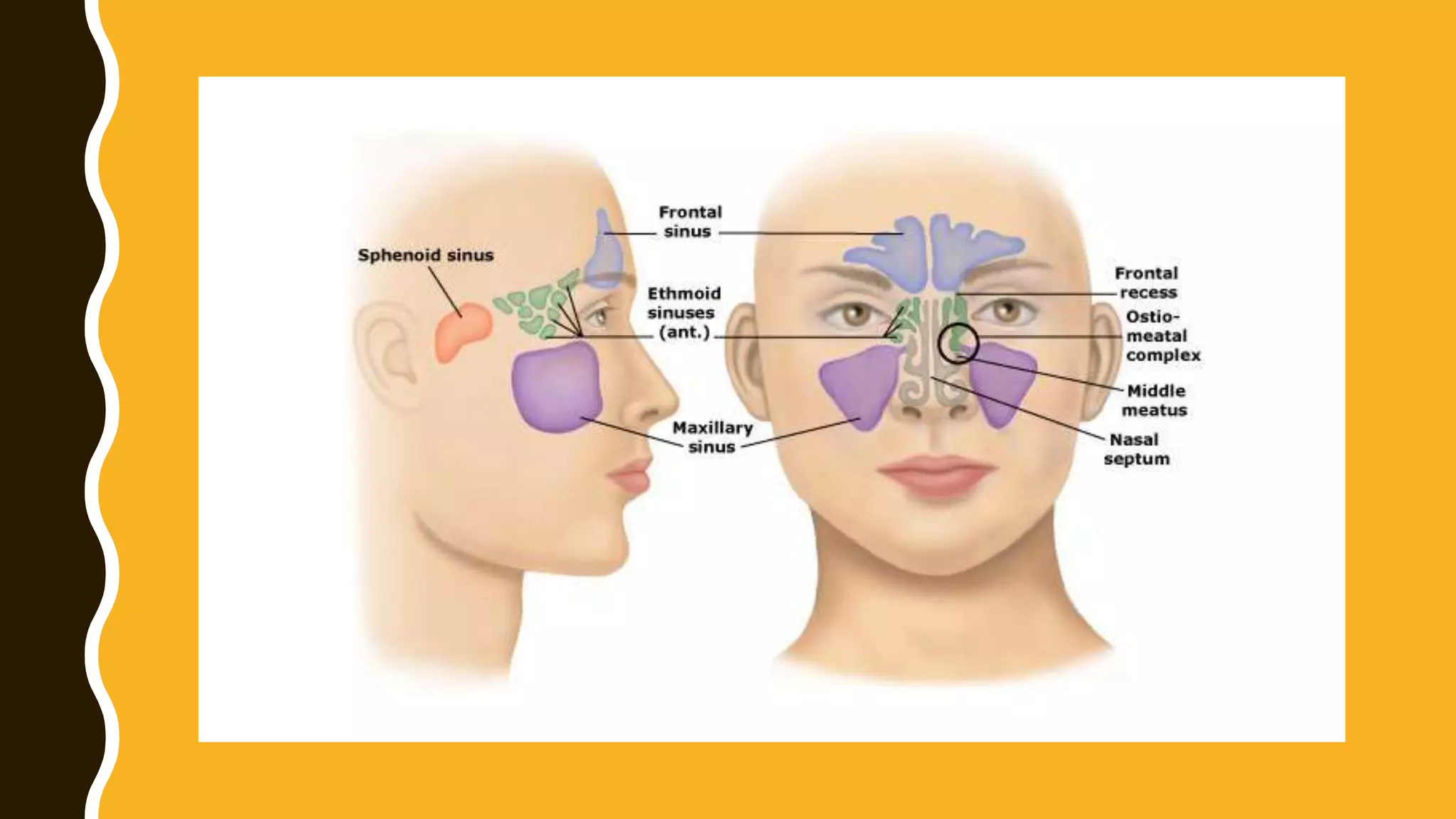 Maxillary sinus aishu.pptx