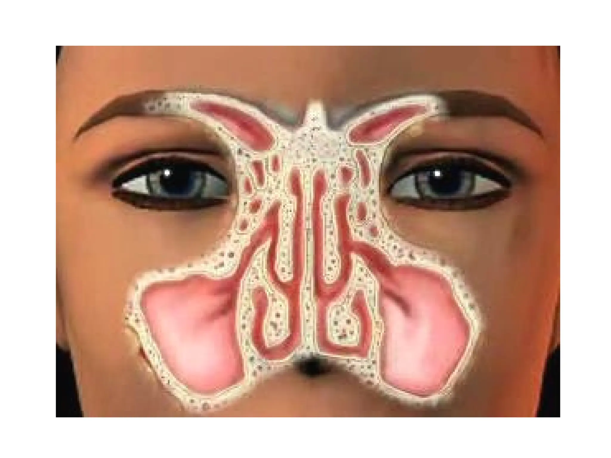 MAXILLARY SINUS AND ITS SURGICAL ANATOMY (2) (1) [Autosaved].ppt