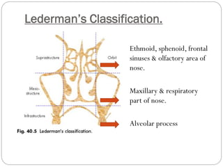 Maxillary sinus carcinoma | PPTX