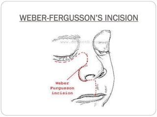 Maxillary sinus carcinoma | PPT