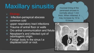 Maxillary sinus diseases | PPTX