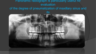 Maxillary sinus diseases | PPTX