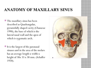 MAXILLARY SINUS ELEVATION floor for implant | PPTX
