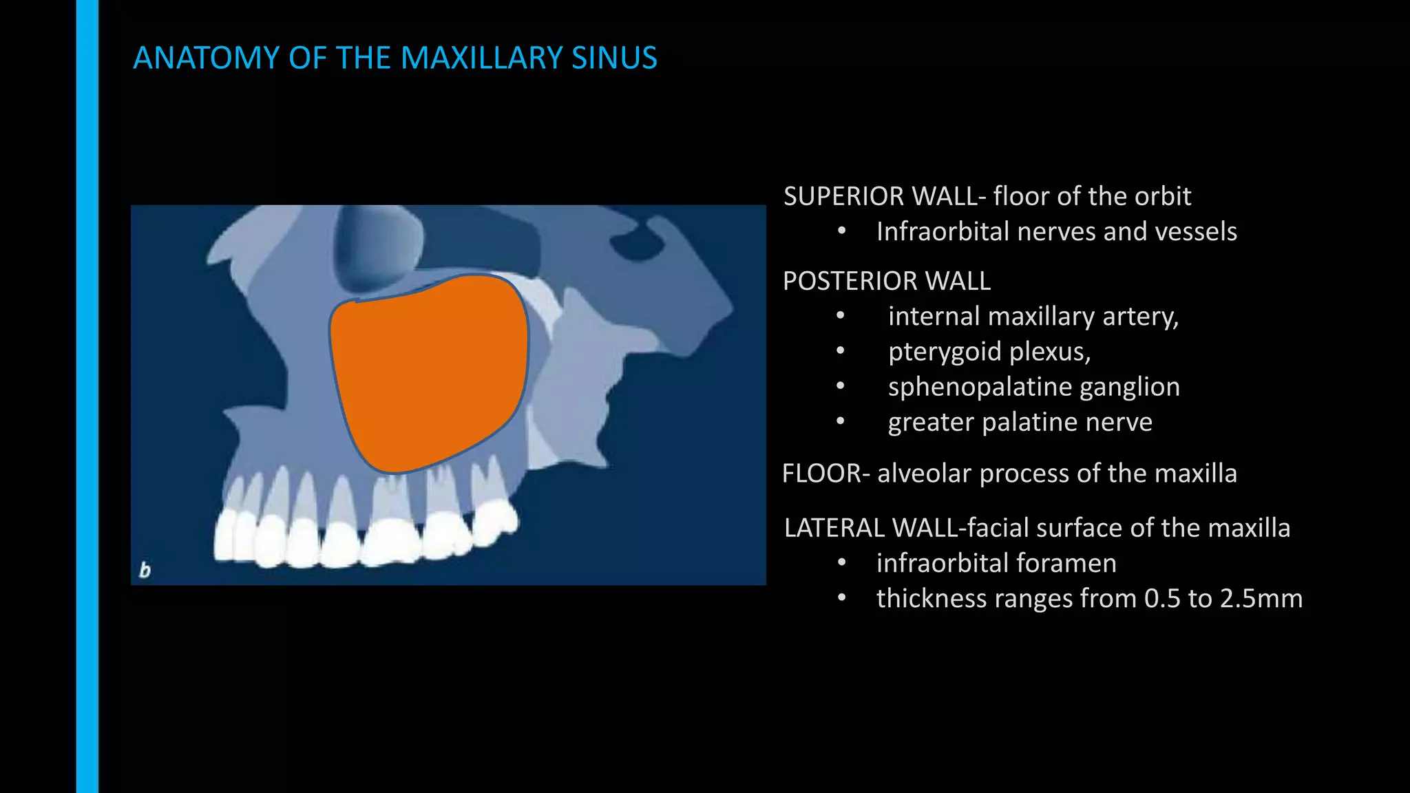 Maxillary sinus floor elevation | PPTX