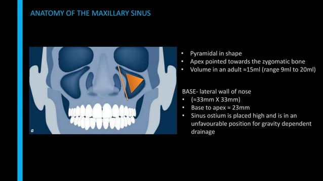 Maxillary sinus floor elevation | PPT