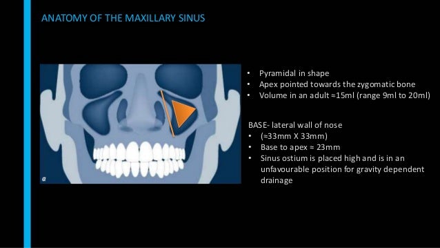 Maxillary sinus floor elevation