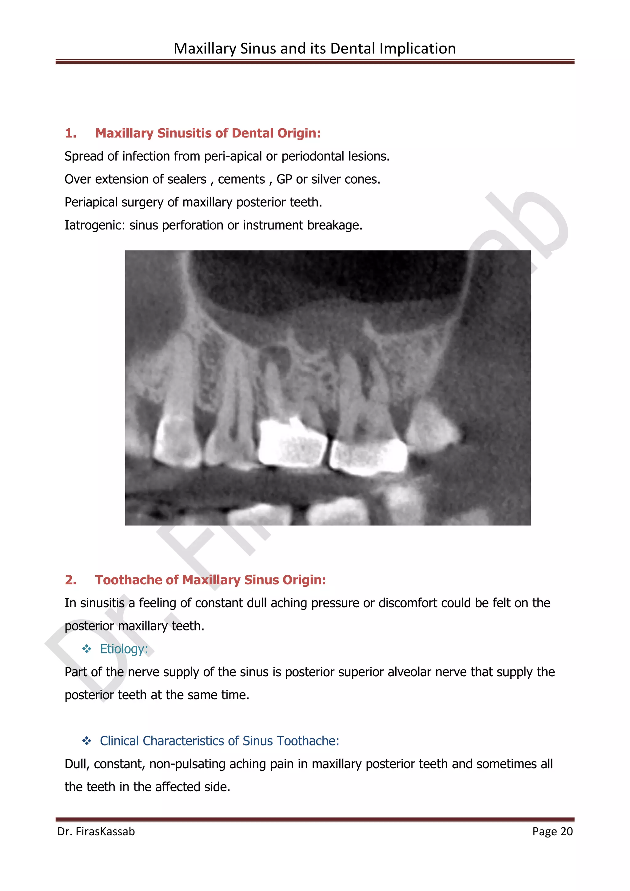 Maxillary sinus & its dental implication | PDF