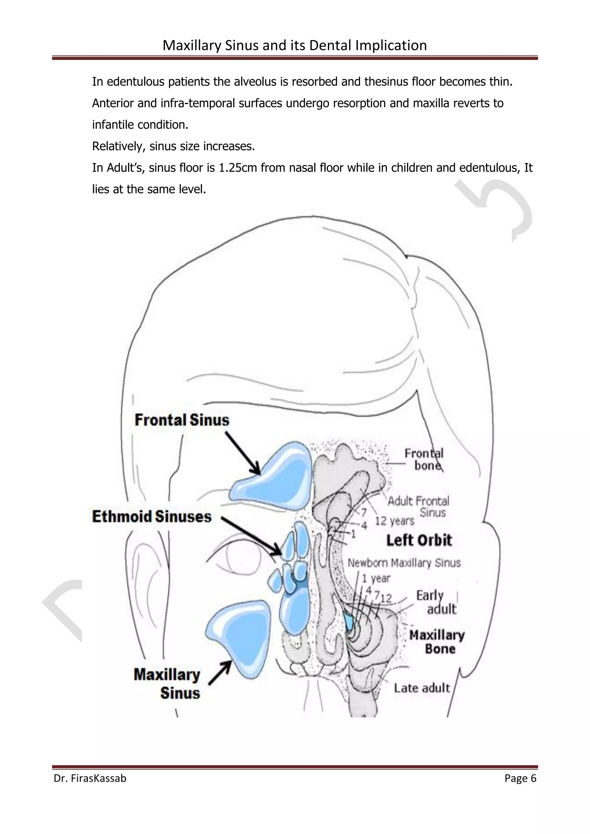 Maxillary sinus & its dental implication | PDF