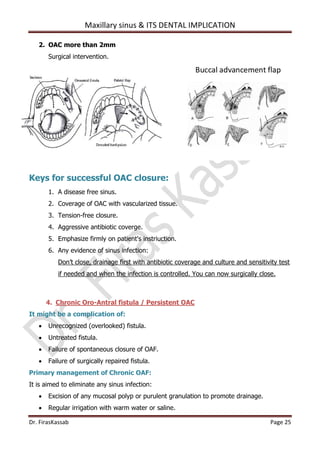 Maxillary sinus & its dental implication | PDF