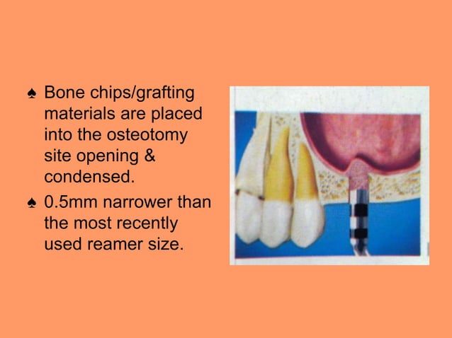 MAXILLARY SINUS LIFT PROCEDURES.ppt