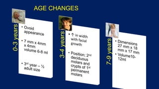maxillary sinus anatomy histology.pptx