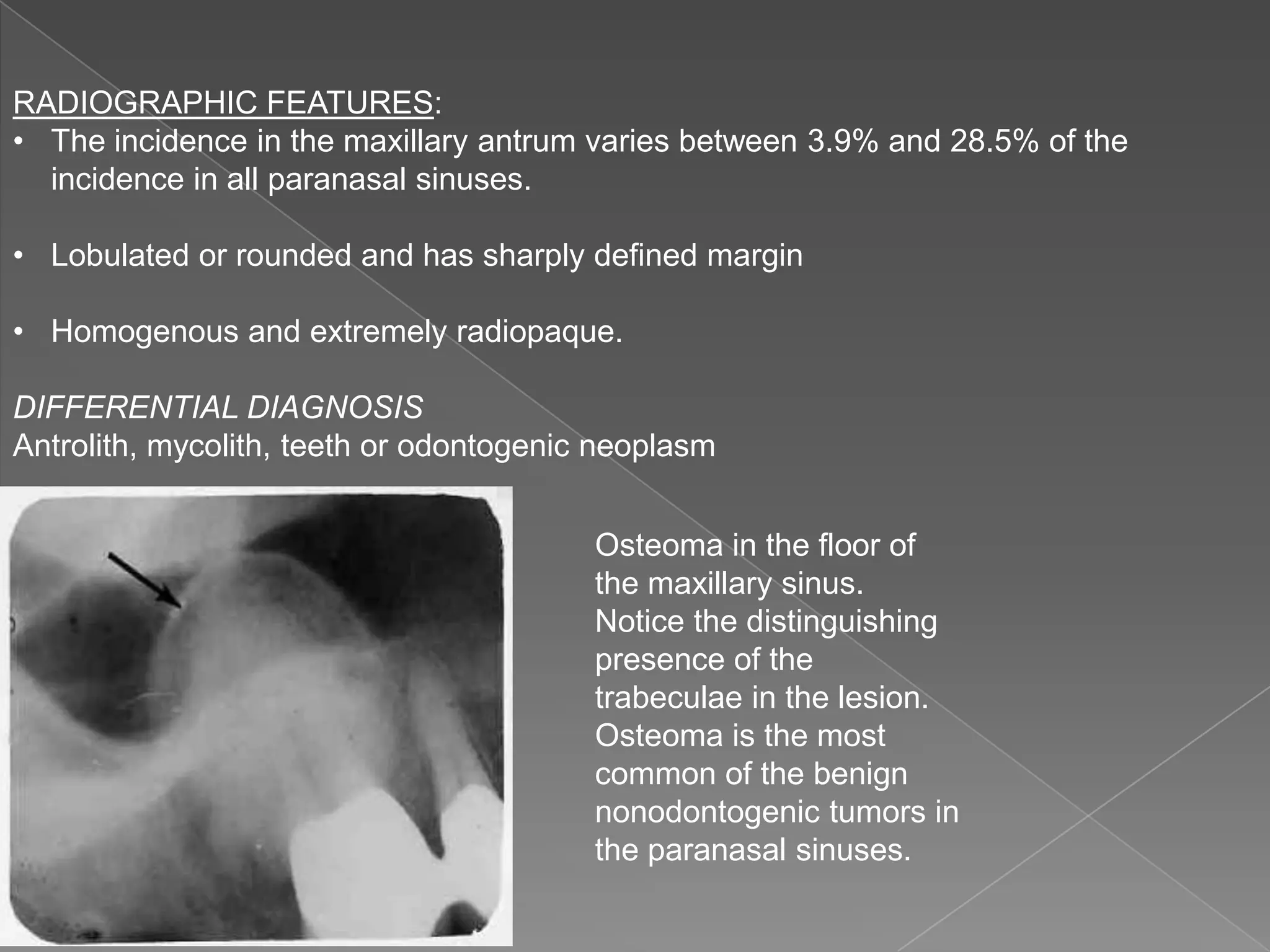 Maxillary sinus new | PPTX