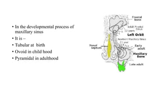 Maxillary sinus part 1 | PPTX