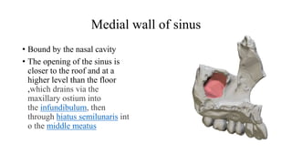 Maxillary sinus part 1 | PPTX