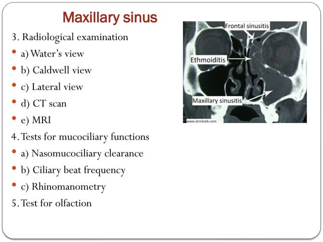maxillarysinuspresentation-201208183440.pptx