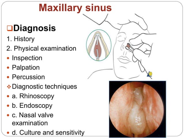 Maxillary sinus presentation | PPTX