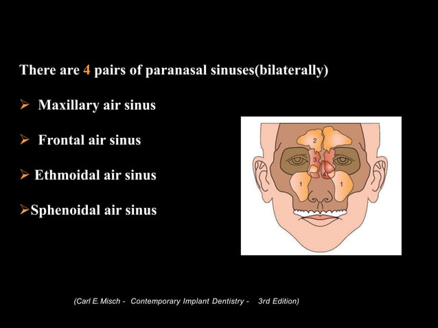 maxillarysinus and antrum of highmore.pptx