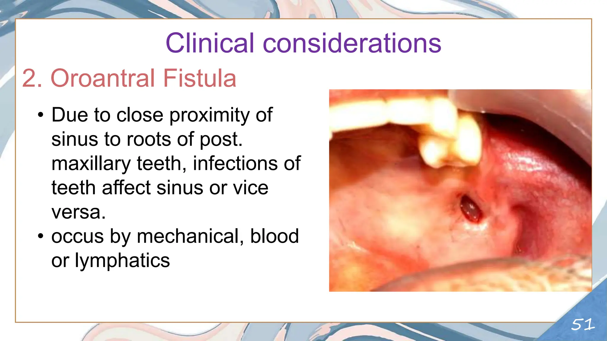 maxillary sinus anatomy histology oralbio | PPTX