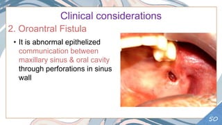 maxillary sinus anatomy histology oralbio | PPTX