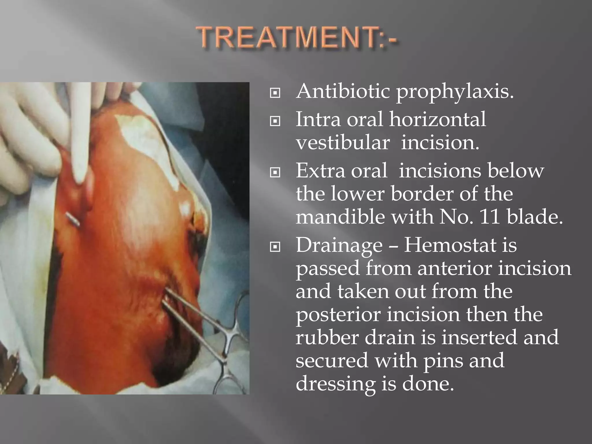 Maxillary space infection | PPTX