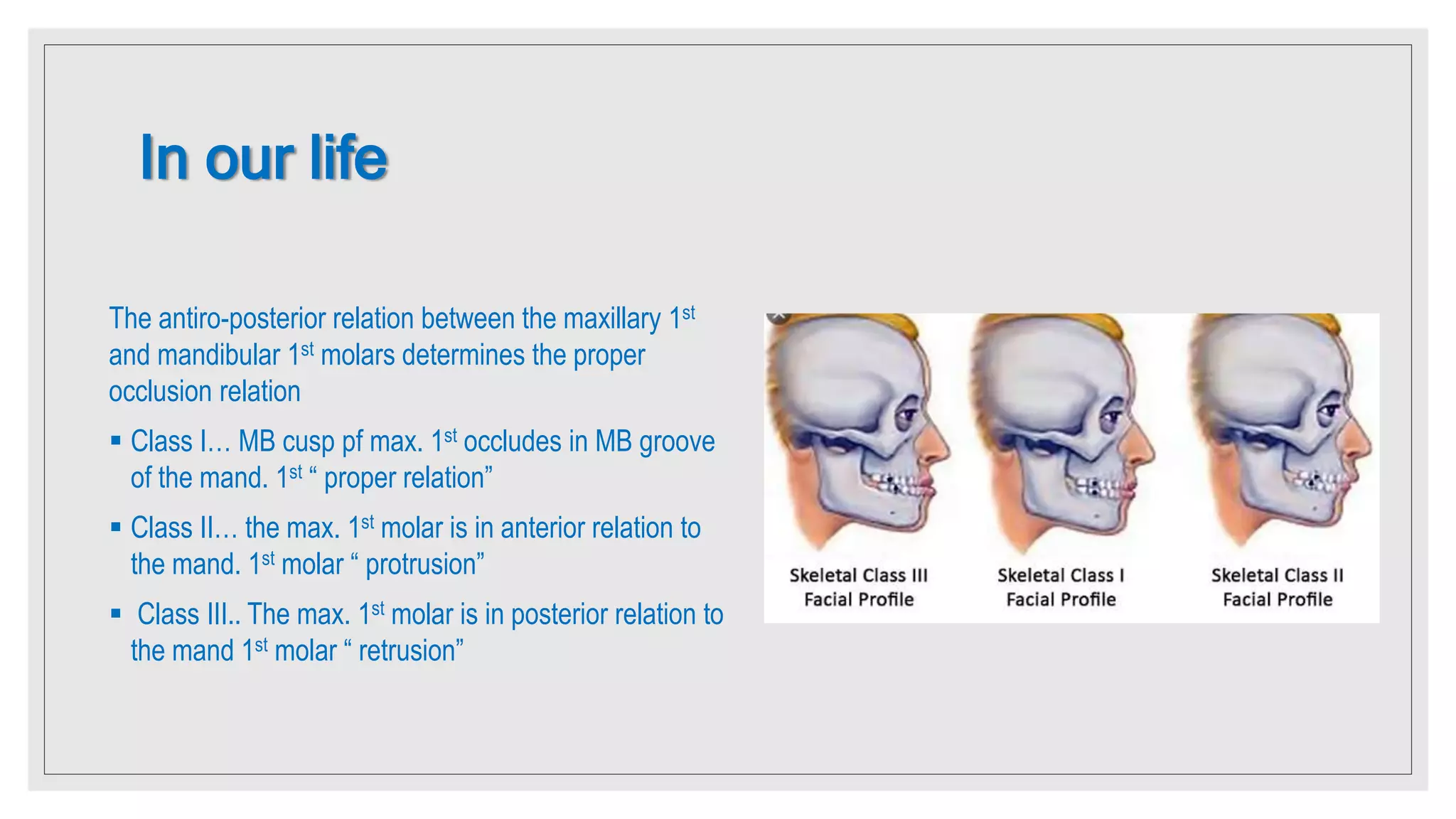 Maxillay first molar | PPTX