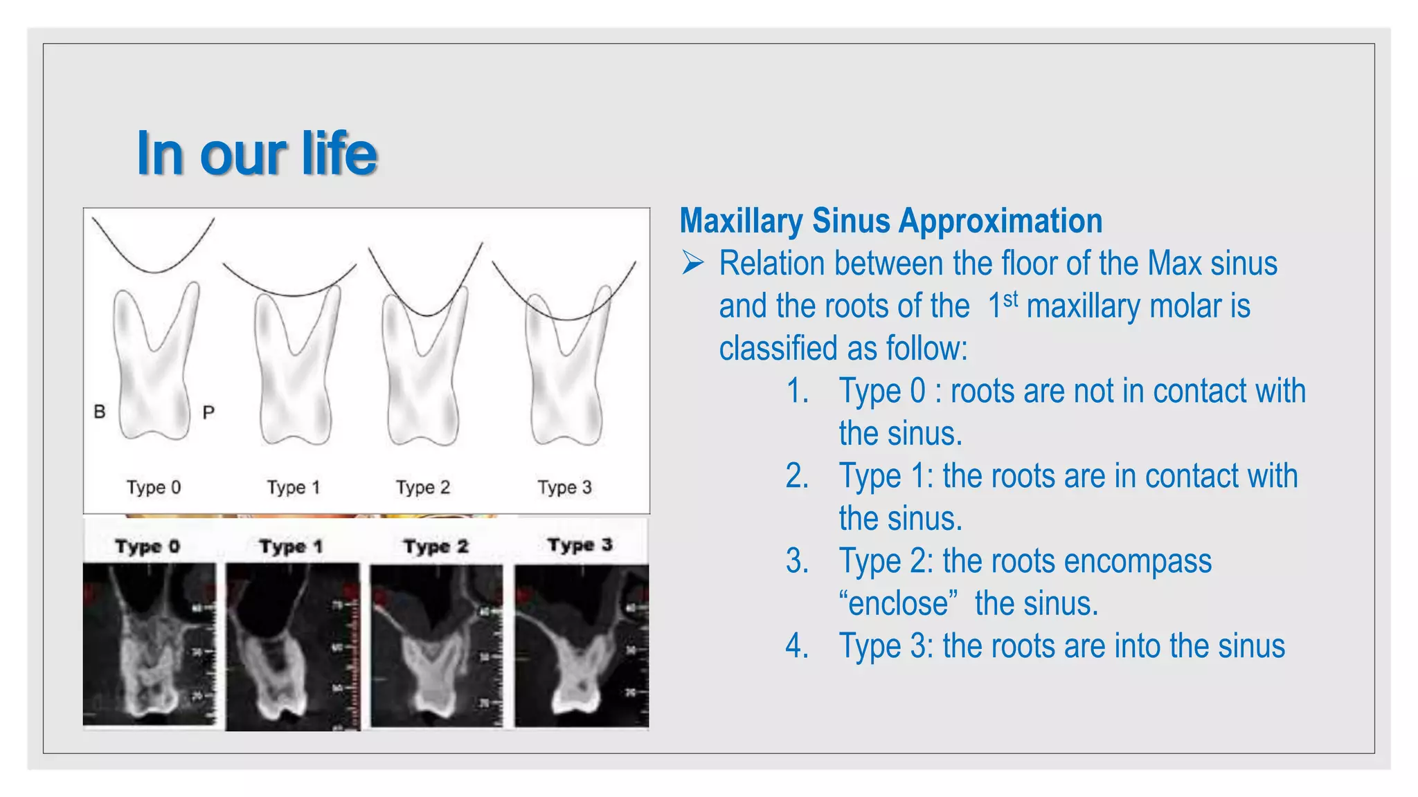 Maxillay first molar | PPTX
