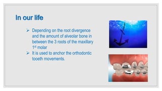 Maxillay first molar | PPTX