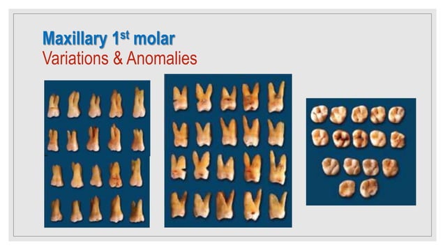 Maxillay first molar | PPT