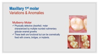 Maxillay first molar | PPT