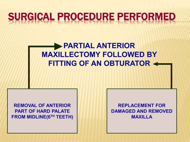 Maxillectomy | PPTX