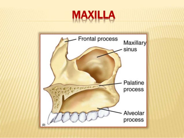 Maxillectomy