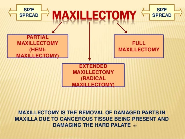 Maxillectomy