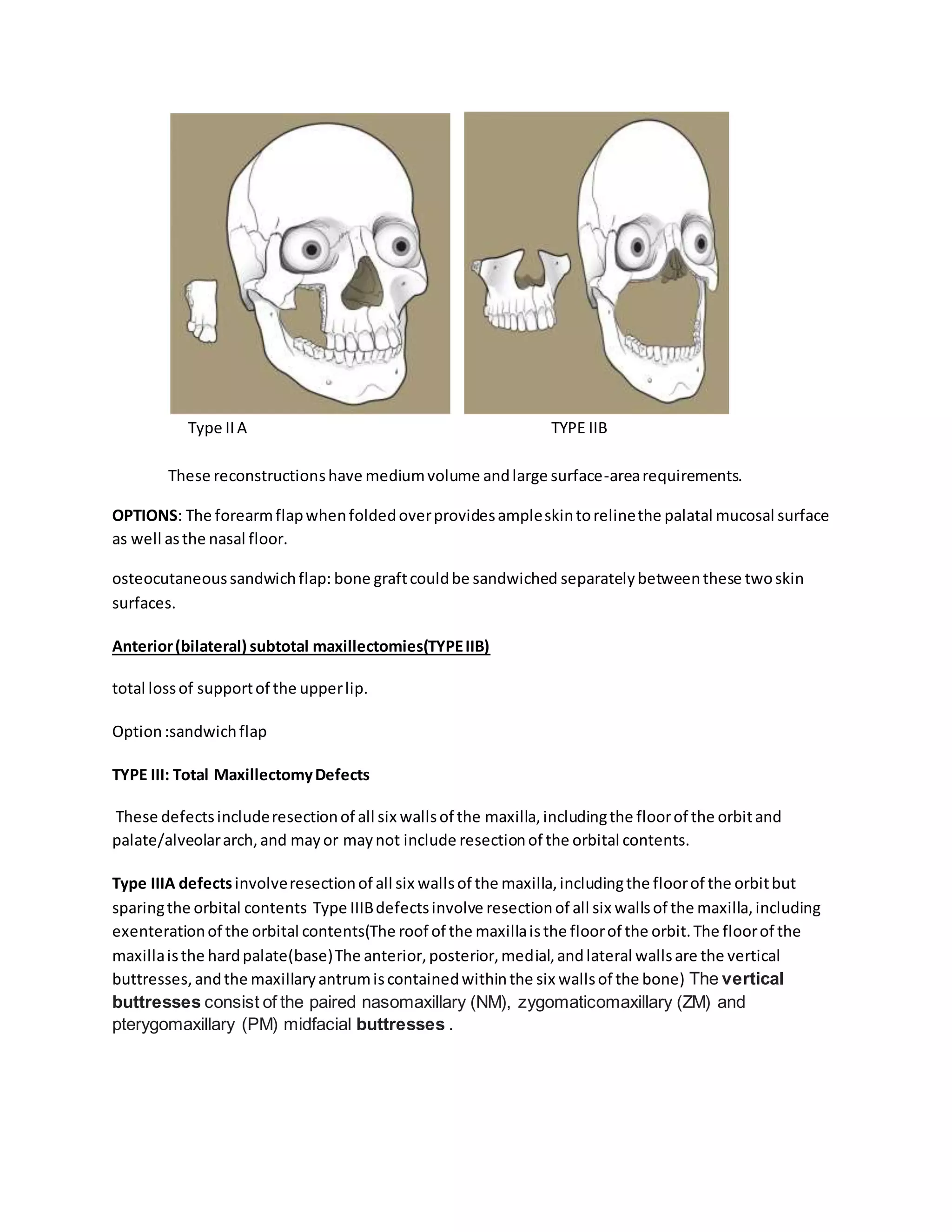 Maxillectomy defect classifications cordeiro | DOCX