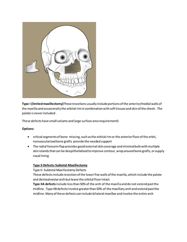 Maxillectomy defect classifications cordeiro | DOCX | Ear, Nose and ...
