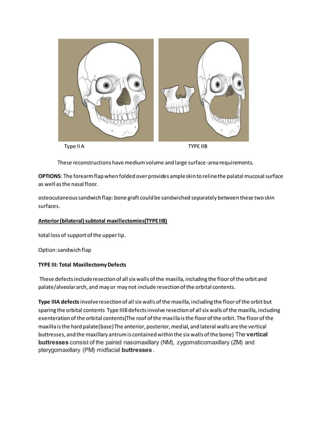 Maxillectomy defect classifications cordeiro | DOCX | Ear, Nose and ...