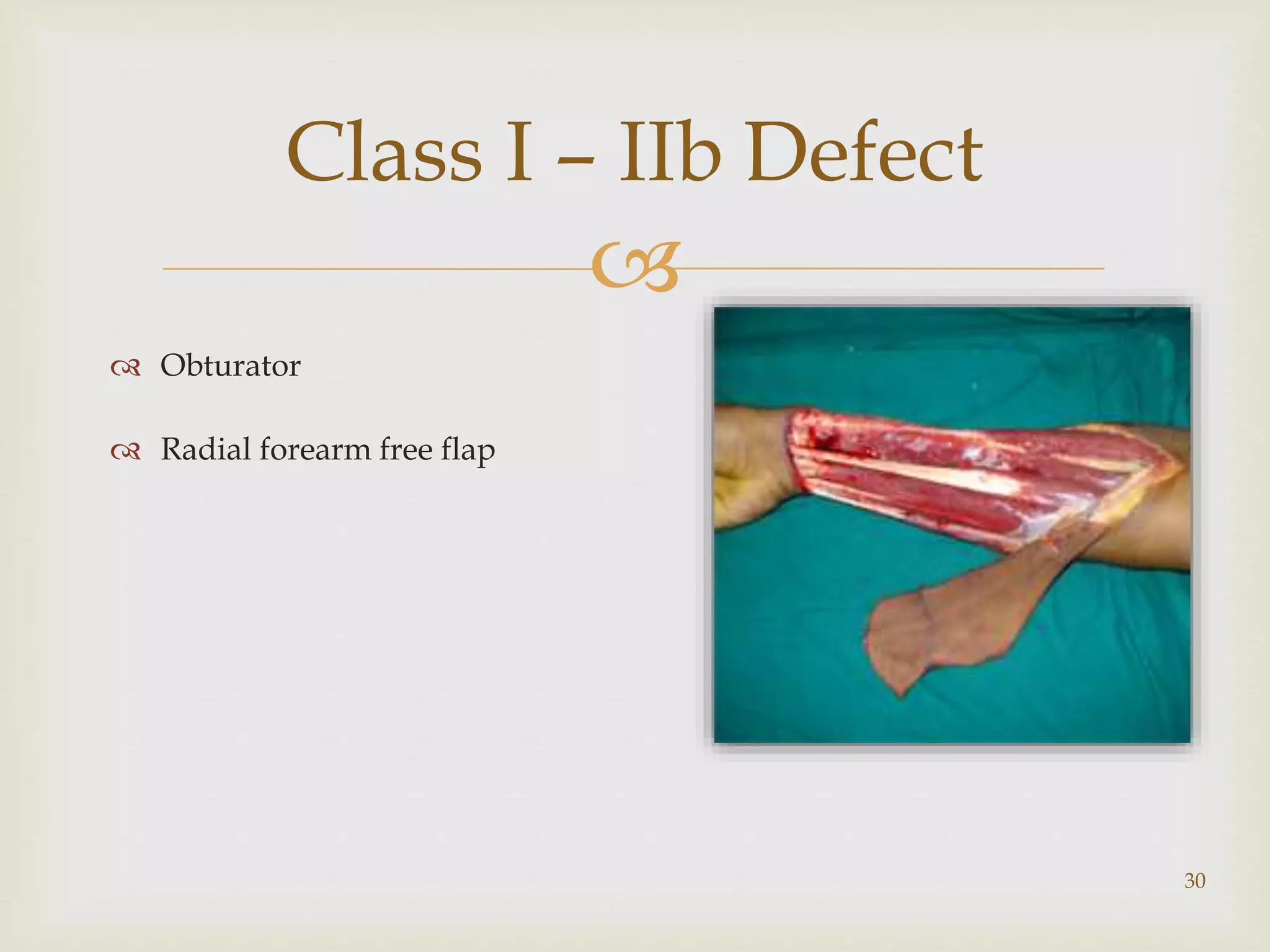 Maxillectomy & Rehabilitation | PPSX