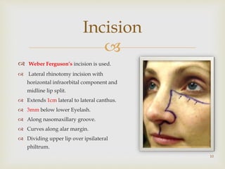 Maxillectomy & Rehabilitation | PPSX | Ear, Nose and Throat Conditions ...