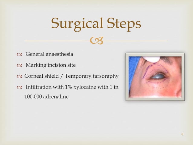 Maxillectomy & Rehabilitation | PPSX | Ear, Nose and Throat Conditions ...