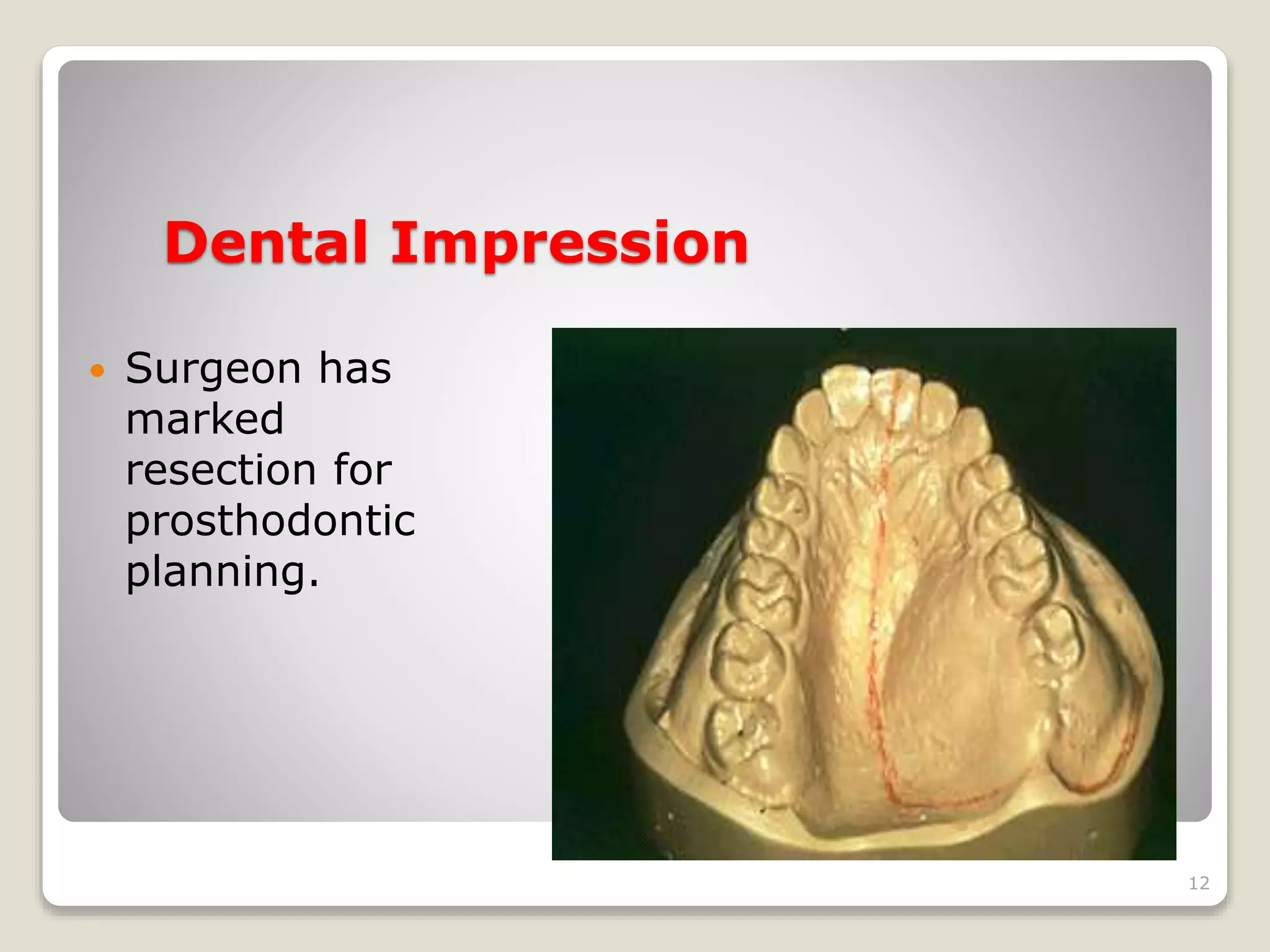 Maxillofacial prosthesis | PPTX